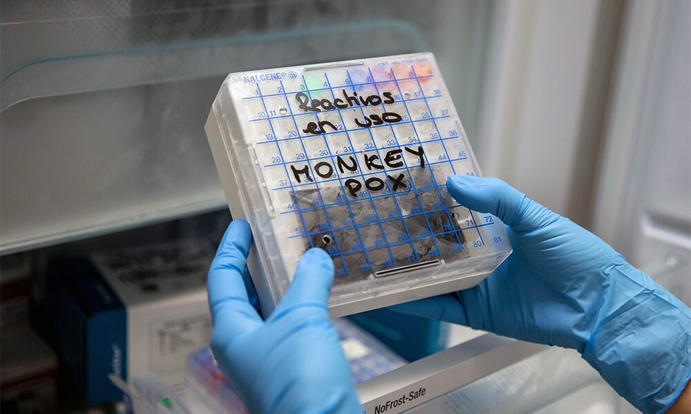 Monkeypox cases rise by 77% in latest WHO weekly count | Ariana News ...