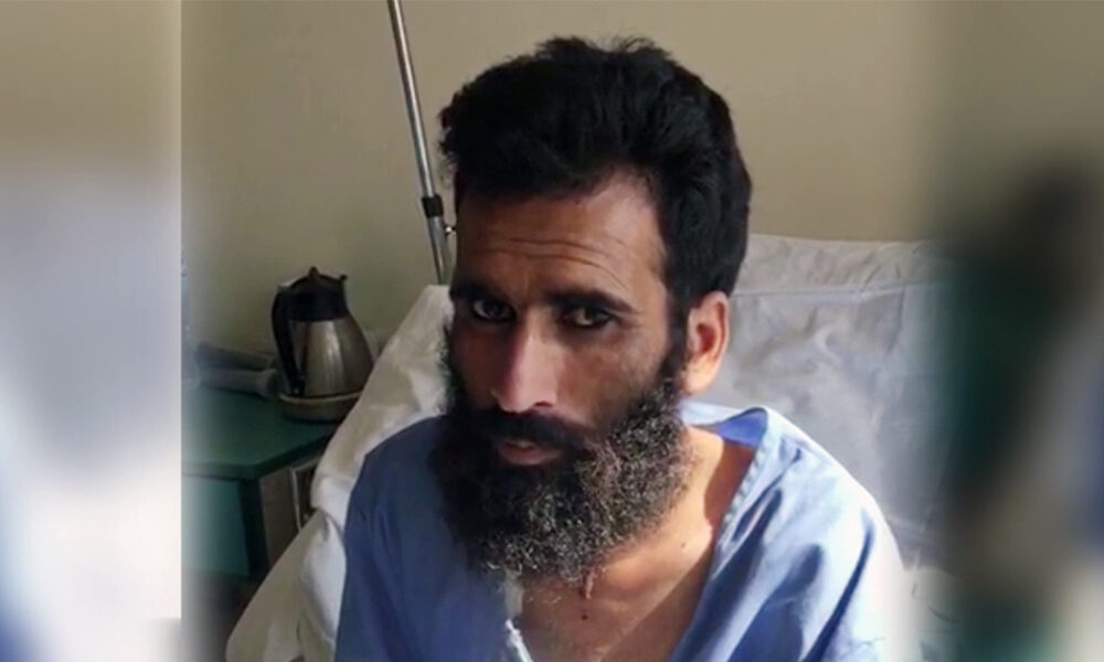 Afghan doctors make history in the country, perform complicated ...